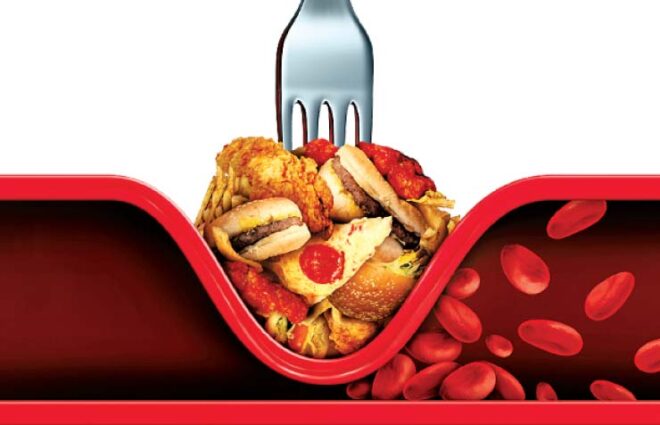 Control High Cholesterol (Dyslipidemia) With Medical Foods and Clean Living